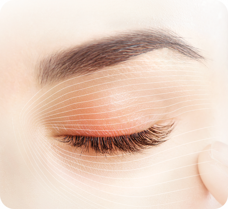 Homepage - BlephaDerm